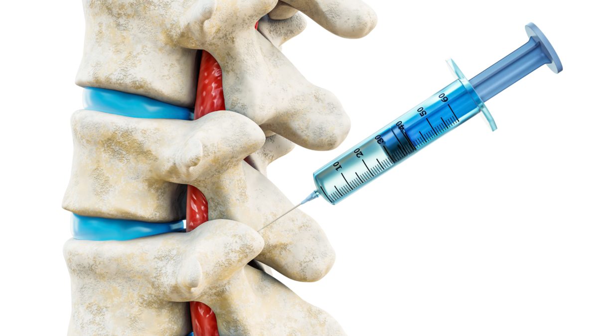 Types Of Spinal Injections New Jersey Comprehensive Spine Care Types Of Spinal Injections New Jersey Comprehensive Spine Care